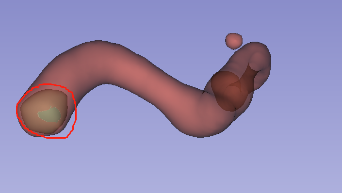 Problems about Organ Segmentation Overlapping · Issue #168 · wasserth/TotalSegmentator · GitHub