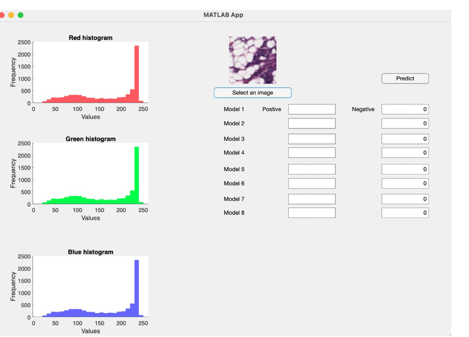 GitHub - OmarElsakka1/IDC_Classification-using-DL: Deep Learning for Invasive Ductal Carcinoma ...