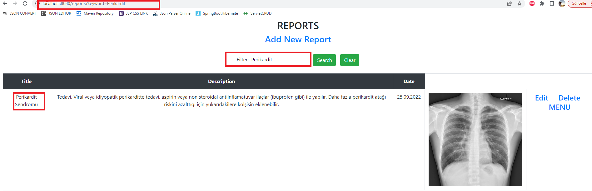 GitHub - eraynaccarli/labProject: SpringMVC,Thymeleaf,Bootstap,Hibernate,Mysql