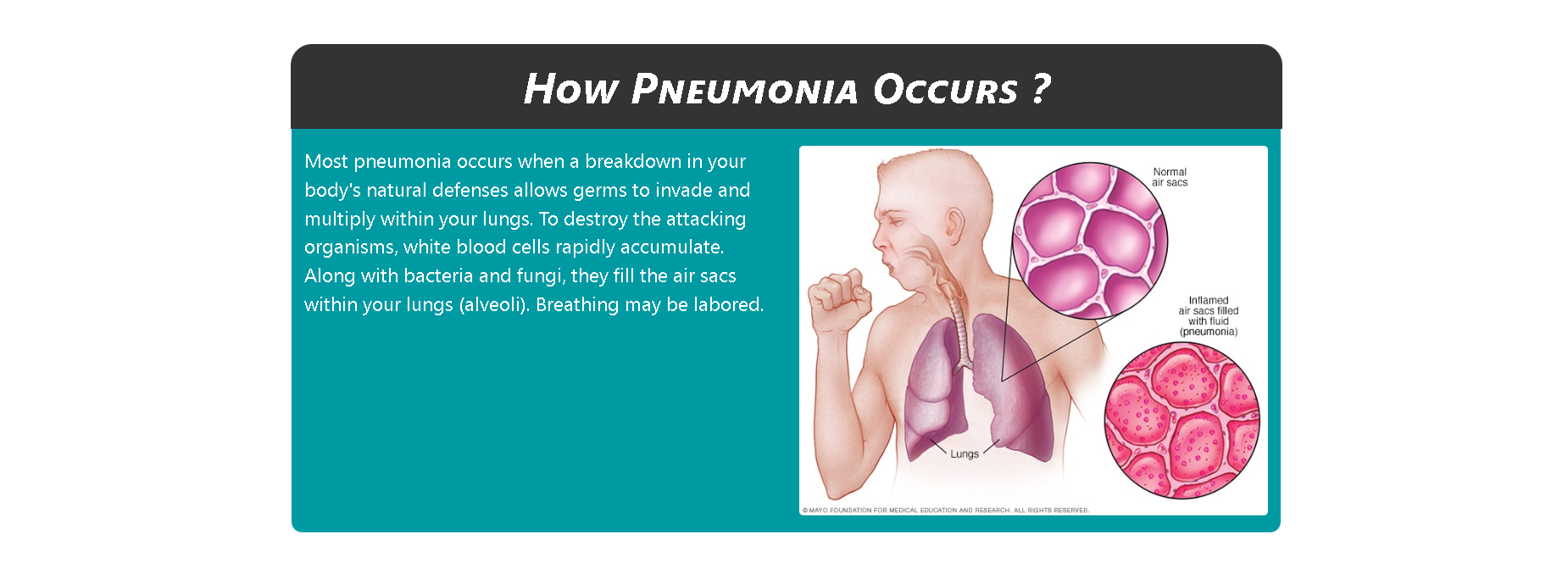 GitHub - har932/Pneumonia-Detection
