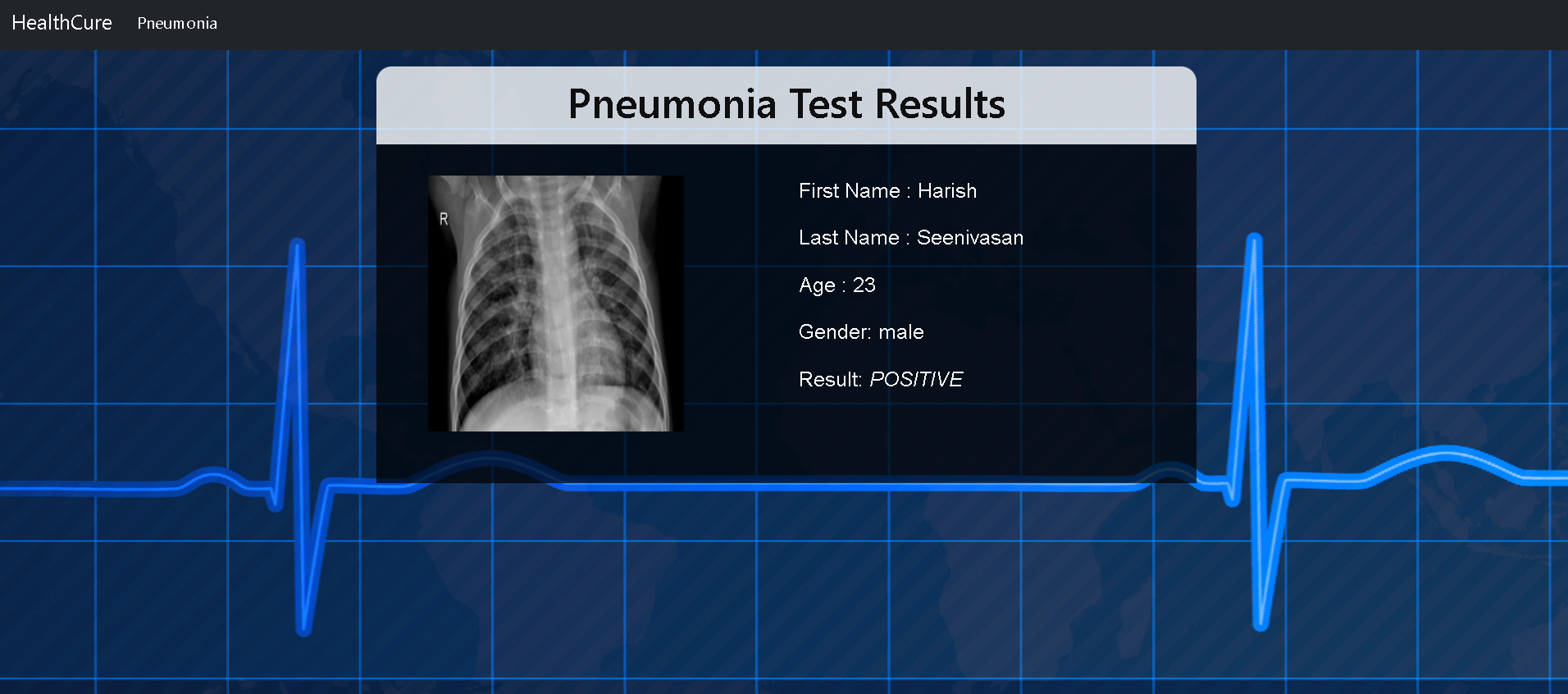 GitHub - har932/Pneumonia-Detection