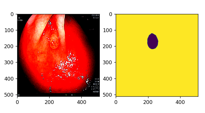 Effect of reduce_zero_label · Issue #1714 · open-mmlab/mmsegmentation · GitHub