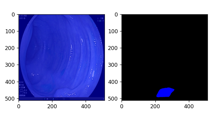 Effect of reduce_zero_label · Issue #1714 · open-mmlab/mmsegmentation · GitHub