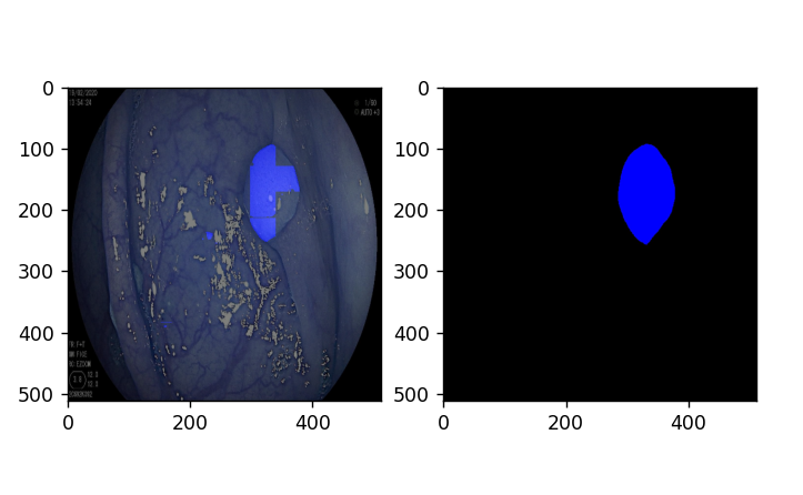 Effect of reduce_zero_label · Issue #1714 · open-mmlab/mmsegmentation · GitHub