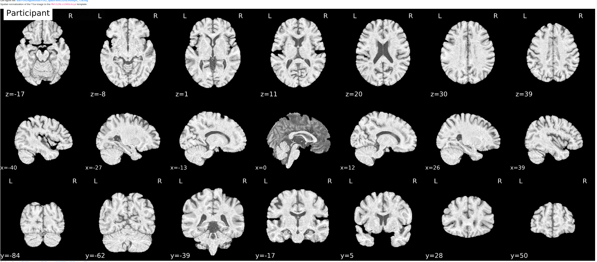 Failed Normalization of BOLD · Issue #2410 · nipreps/fmriprep · GitHub