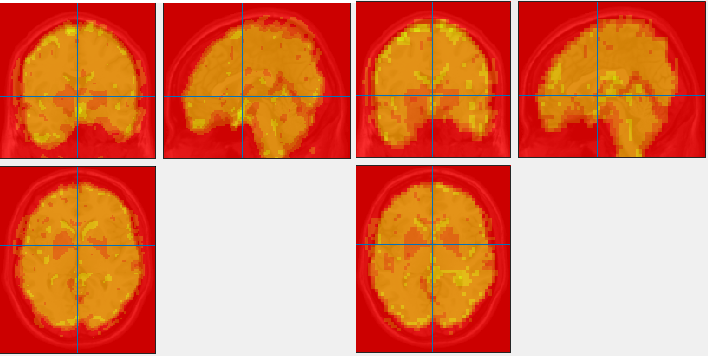 Failed Normalization of BOLD · Issue #2410 · nipreps/fmriprep · GitHub