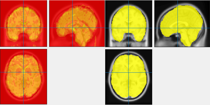 Failed Normalization of BOLD · Issue #2410 · nipreps/fmriprep · GitHub