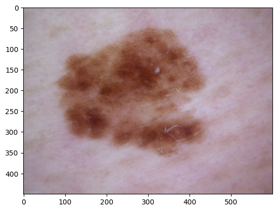 GitHub - Astro3321/skin_cancer_classification: Skin Cancer Detection