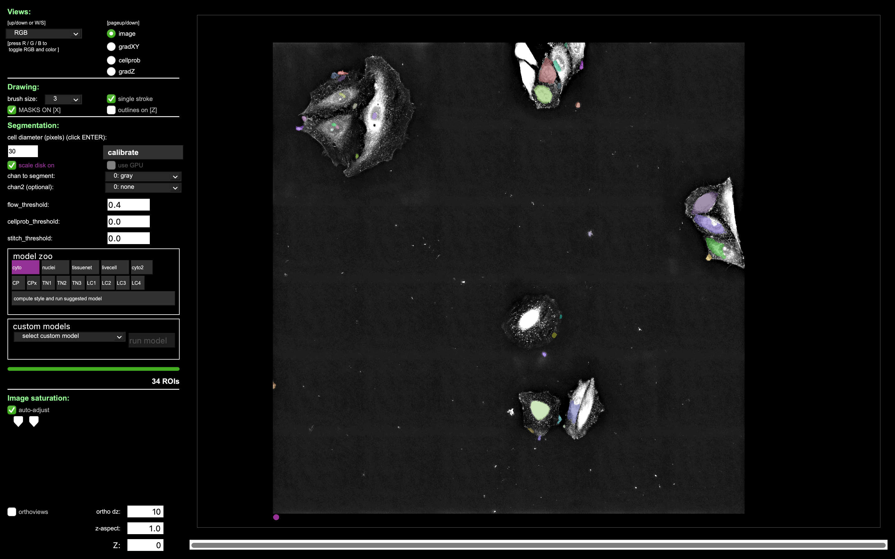 Differences between cellpose performance on the website and GUI · Issue #535 · MouseLand ...