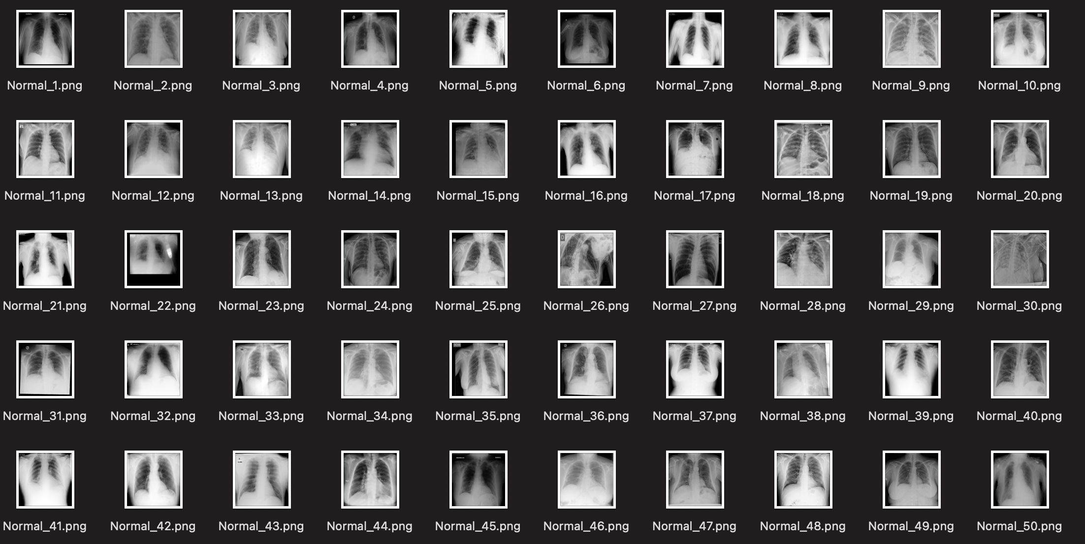 Github Modal Nirogya Cnn Svm Cnn For The Feature Extraction And Svm For The Classification