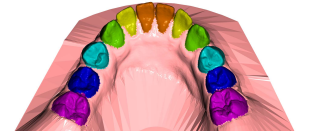 GitHub - limhoyeon/ToothGroupNetwork: 3D Dental surface segmentation ...
