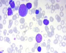 GitHub - taufiq-ai/Vision-Blood-Cancer-Stage-Detection: A Deep Learning based Python Web ...