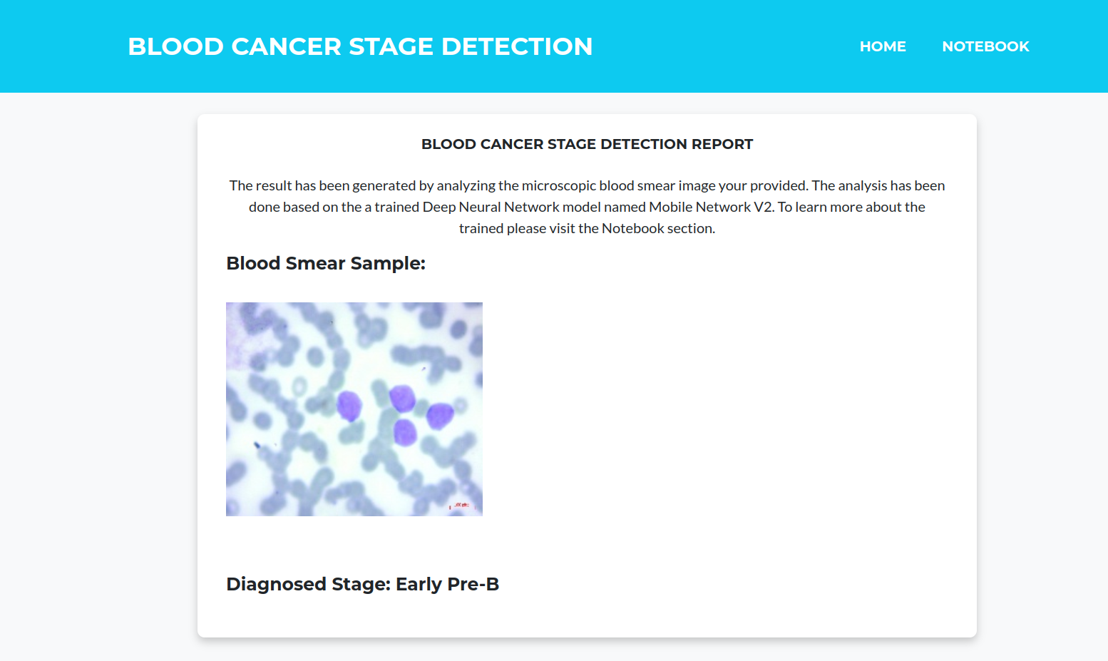 GitHub - taufiq-ai/Vision-Blood-Cancer-Stage-Detection: A Deep Learning based Python Web ...