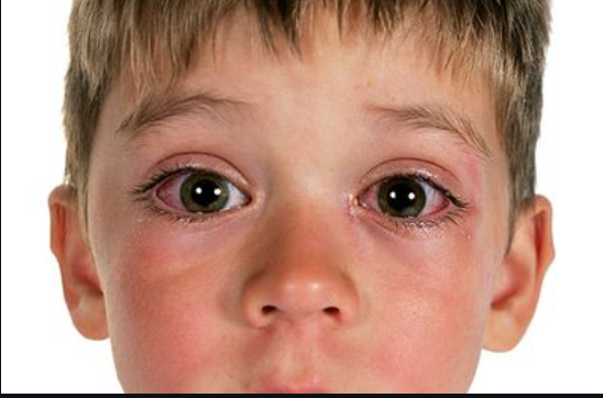 GitHub - RachanaSubedi/Nayan