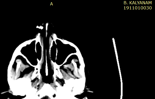 DICOM Print with annotation · Issue #1016 · fo-dicom/fo-dicom · GitHub