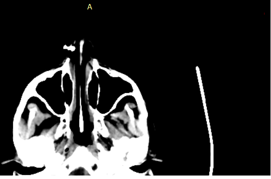Dicom Print With Annotation · Issue 1016 · Fo Dicomfo Dicom · Github