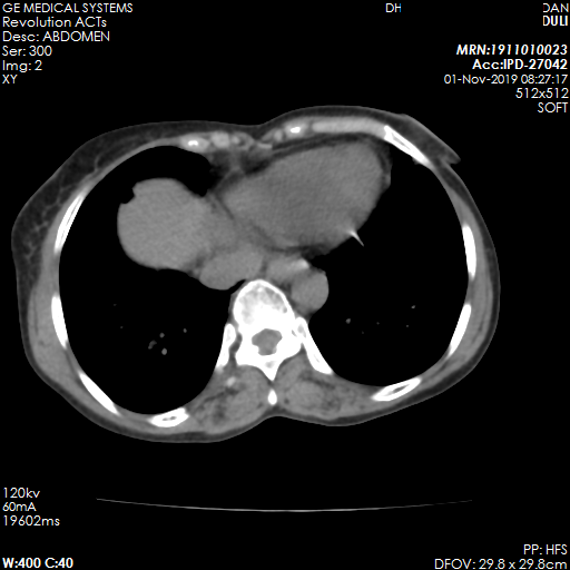 Dicom Print With Annotation · Issue 1016 · Fo Dicomfo Dicom · Github