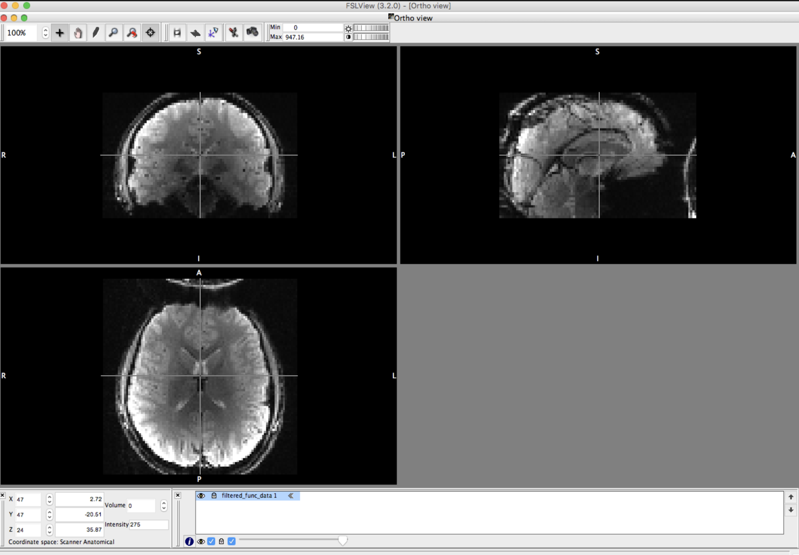 the language network -- see previous ticket · Issue #2275 · OpenNeuroOrg/openneuro · GitHub