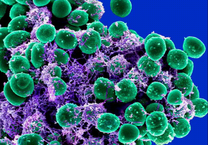 GitHub - luv-bansal/Segment-Anything-Model-SAM-