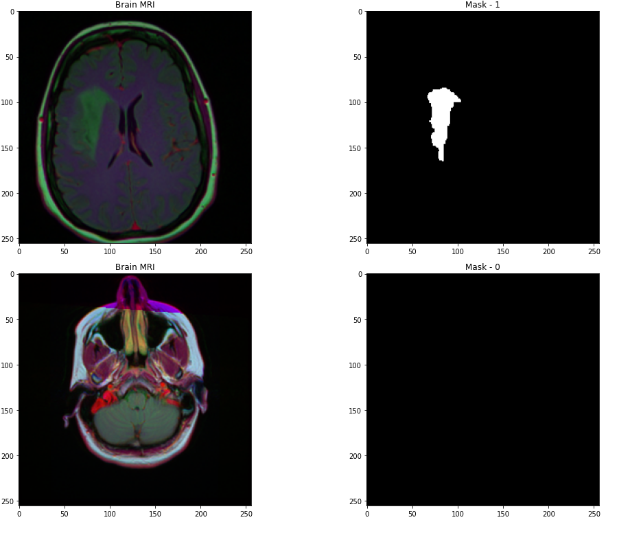 GitHub - KarnikaSoni/BrainTumor_Detection: A project that detects brain ...