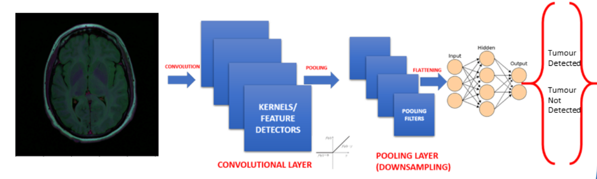 GitHub - KarnikaSoni/BrainTumor_Detection: A project that detects brain ...