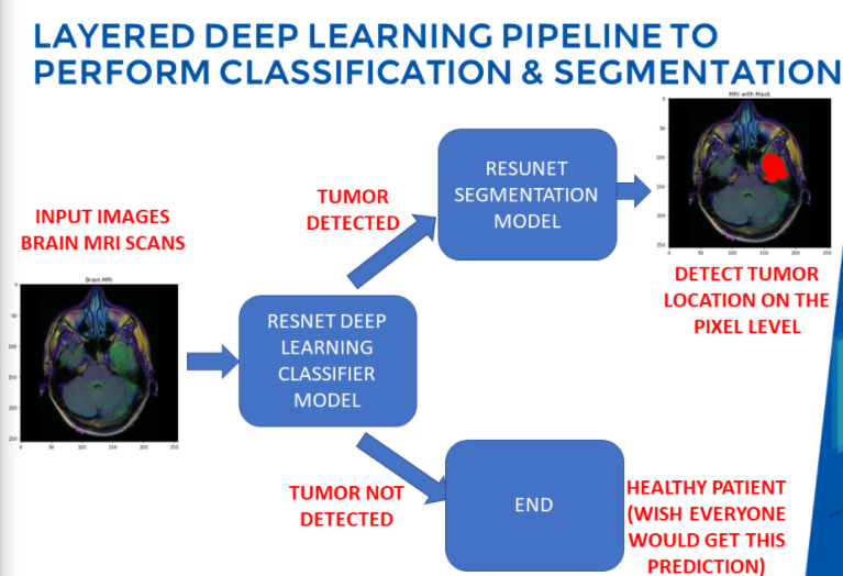 GitHub - KarnikaSoni/BrainTumor_Detection: A project that detects brain ...