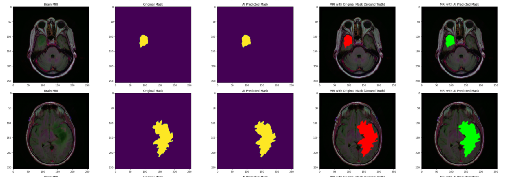 GitHub - KarnikaSoni/BrainTumor_Detection: A project that detects brain ...