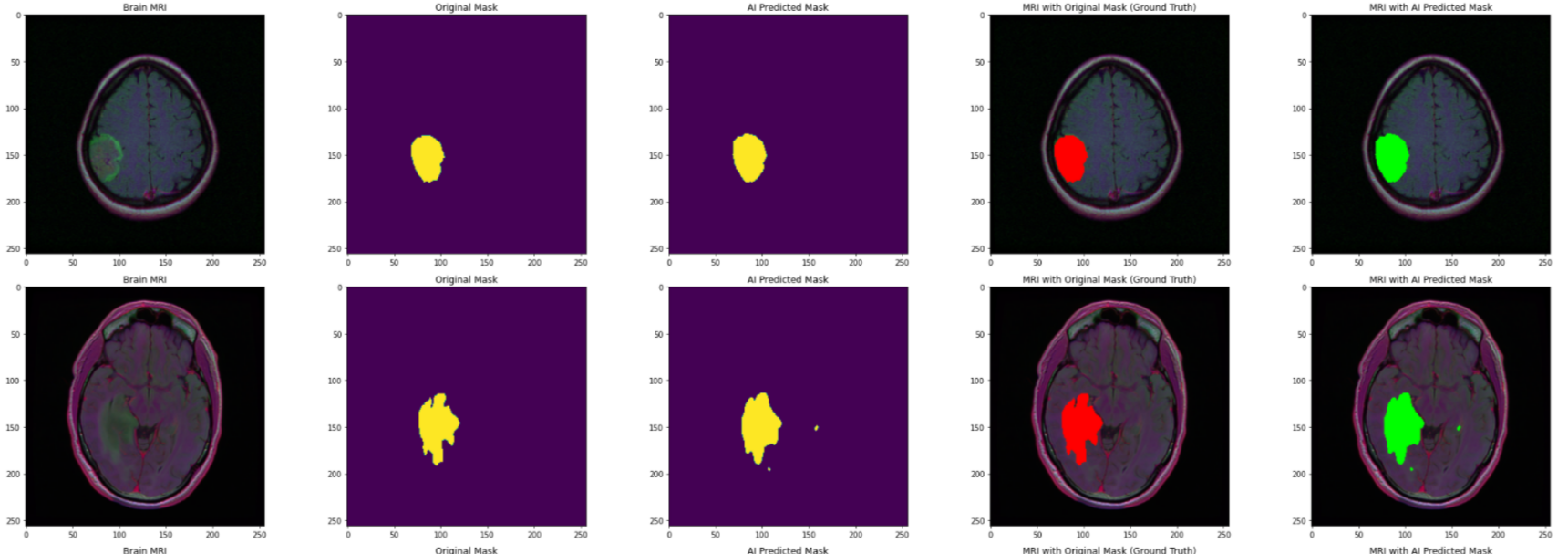 GitHub - KarnikaSoni/BrainTumor_Detection: A project that detects brain ...