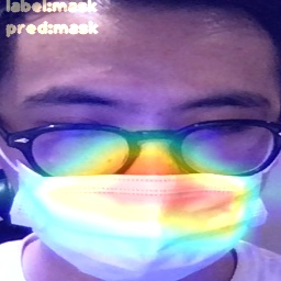 GitHub - saehan-choi/grad_CAM