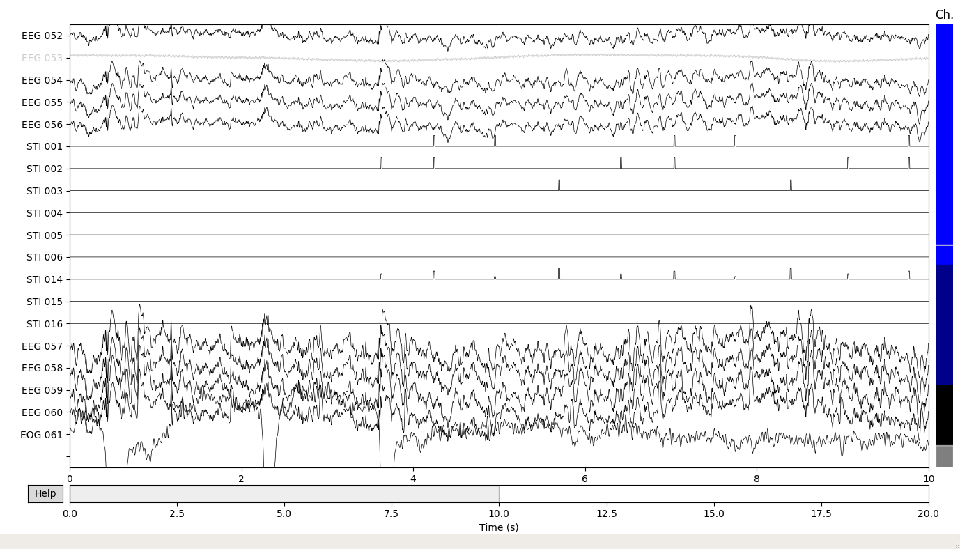 Improve sEEG visualization when plotting · Issue #4912 · mne-tools/mne ...