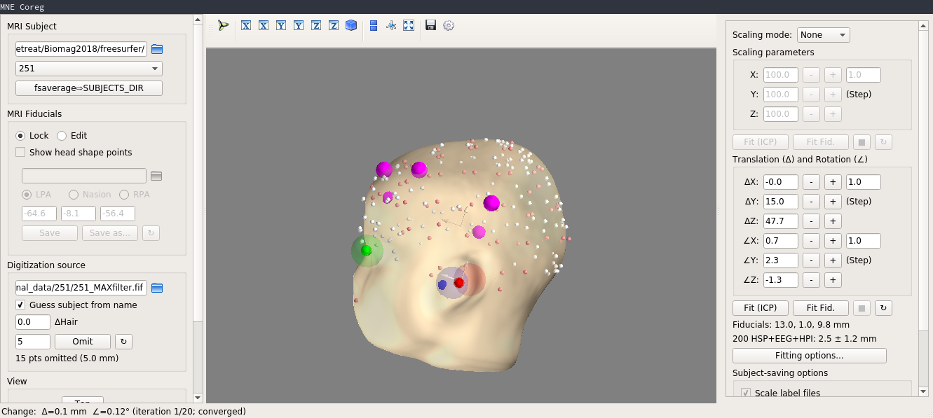 Digitalization source is not flush when changing subject in MNE Coreg ...