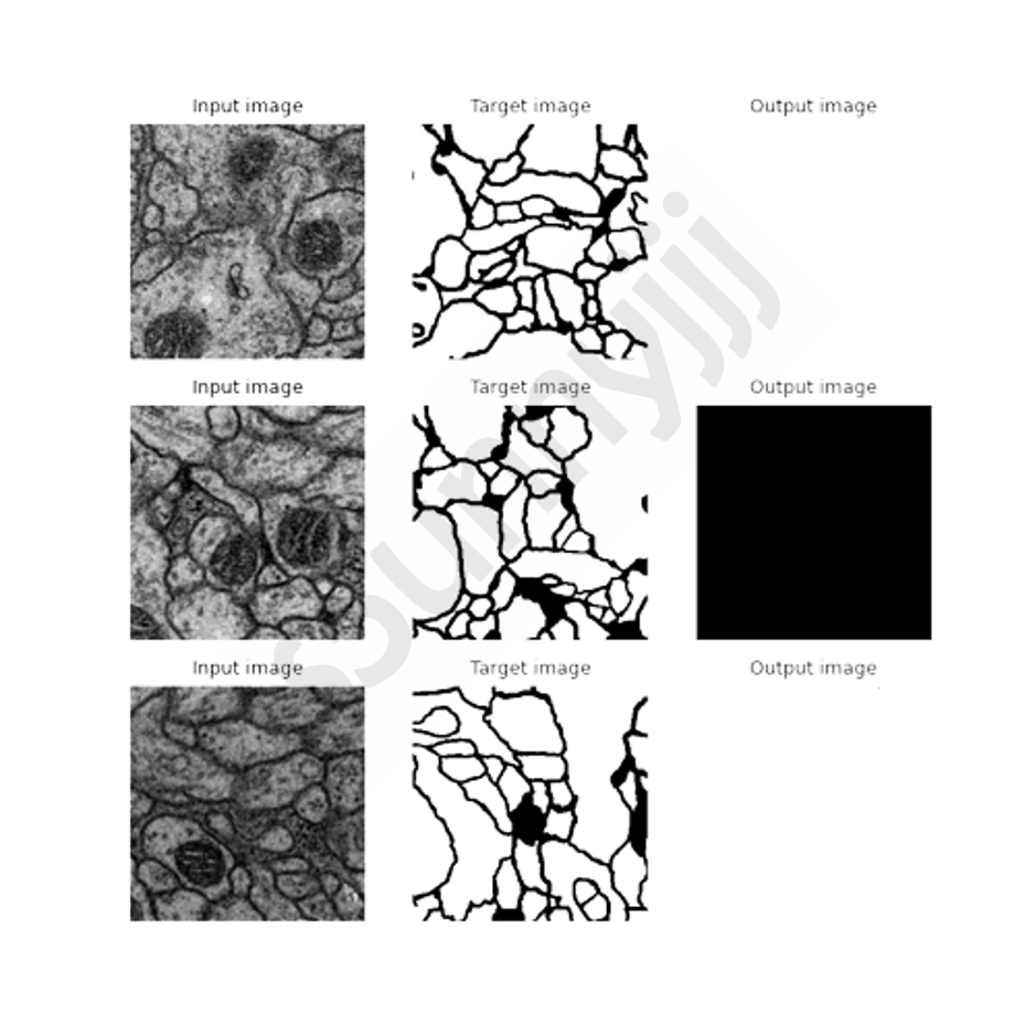 GitHub - s5unnyjjj/U-Net-Biomedical-Image-Segmentation-with-tensorflow