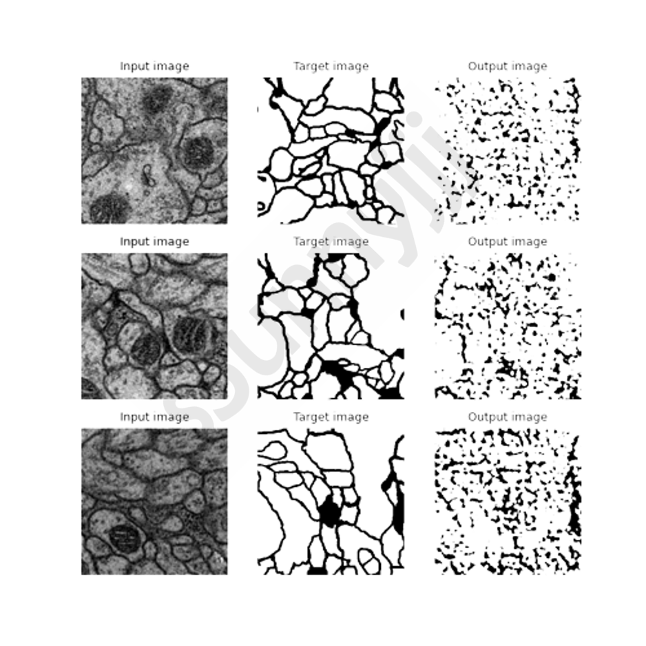 GitHub - s5unnyjjj/U-Net-Biomedical-Image-Segmentation-with-tensorflow