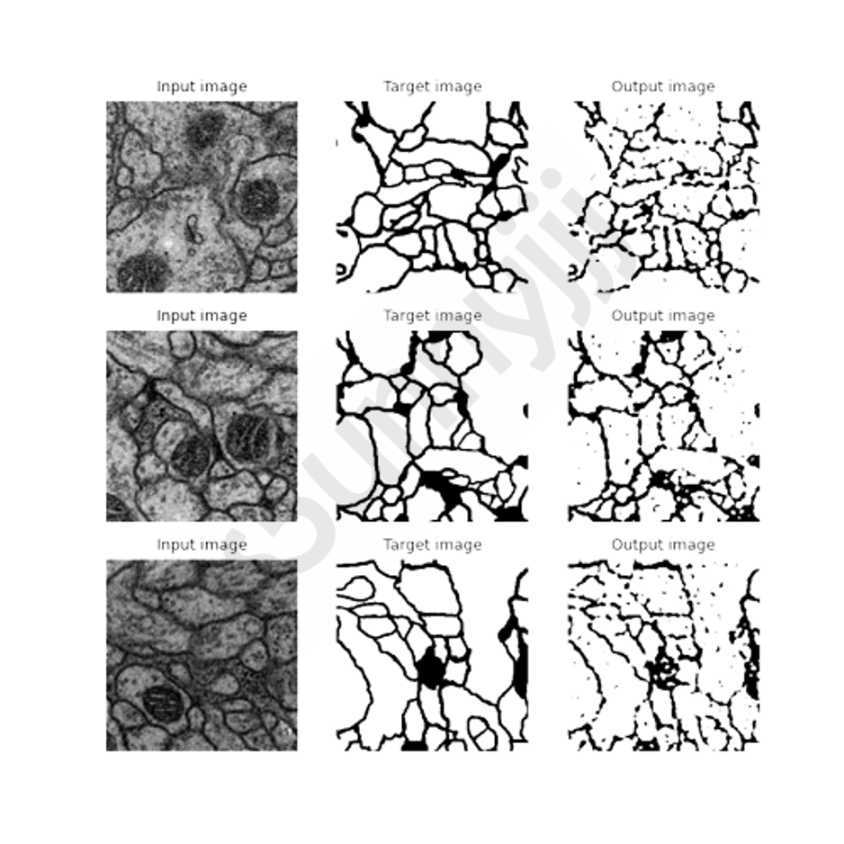 GitHub - s5unnyjjj/U-Net-Biomedical-Image-Segmentation-with-tensorflow