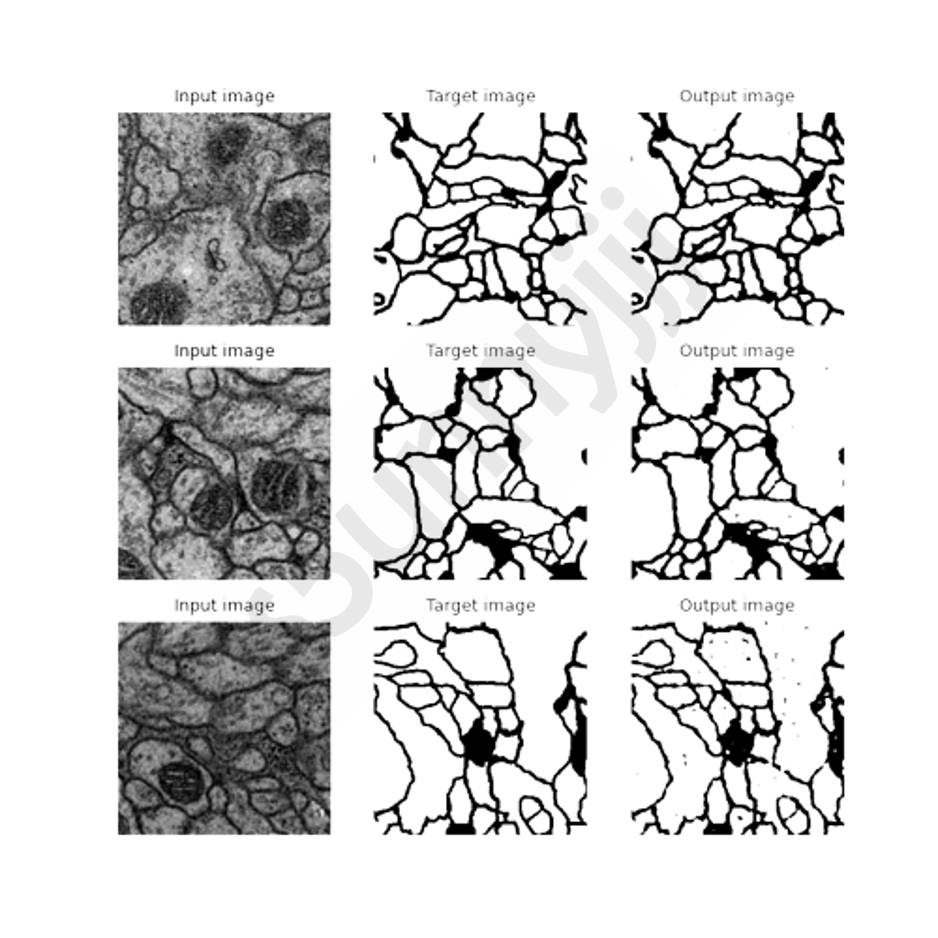 GitHub - s5unnyjjj/U-Net-Biomedical-Image-Segmentation-with-tensorflow