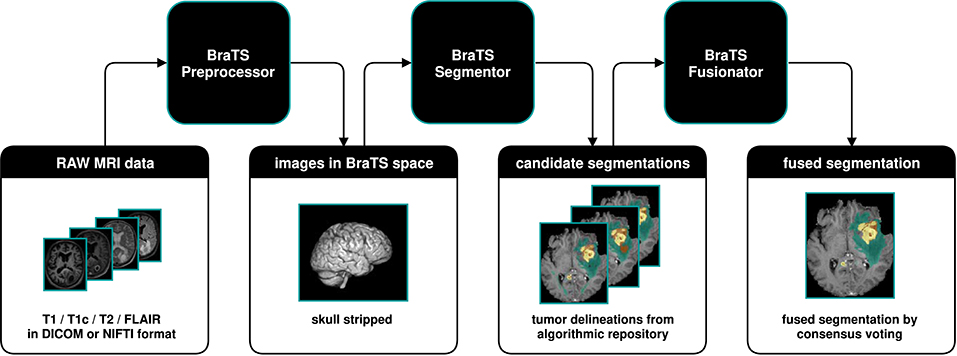 GitHub - neuronflow/BraTS-Toolkit: Code to preprocess, segment, and fuse glioma MRI scans based ...