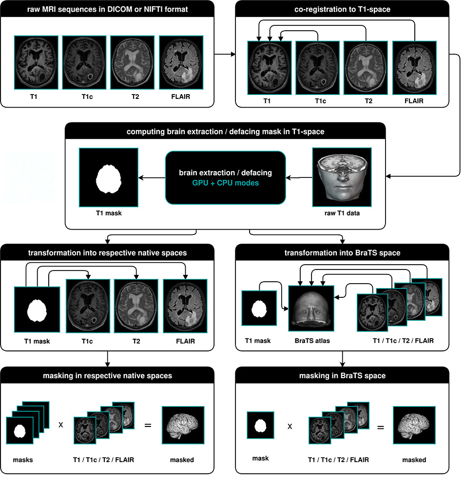 Ability to run BTK without resampling · Issue #32 · neuronflow/BraTS-Toolkit · GitHub
