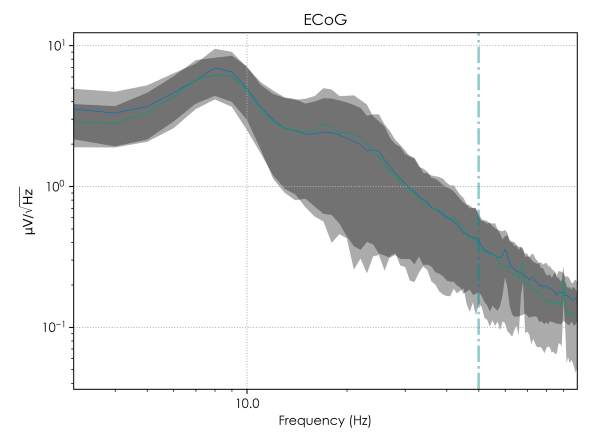 Fix units when reading NeuroOmega files · Issue #2110 · fieldtrip/fieldtrip · GitHub