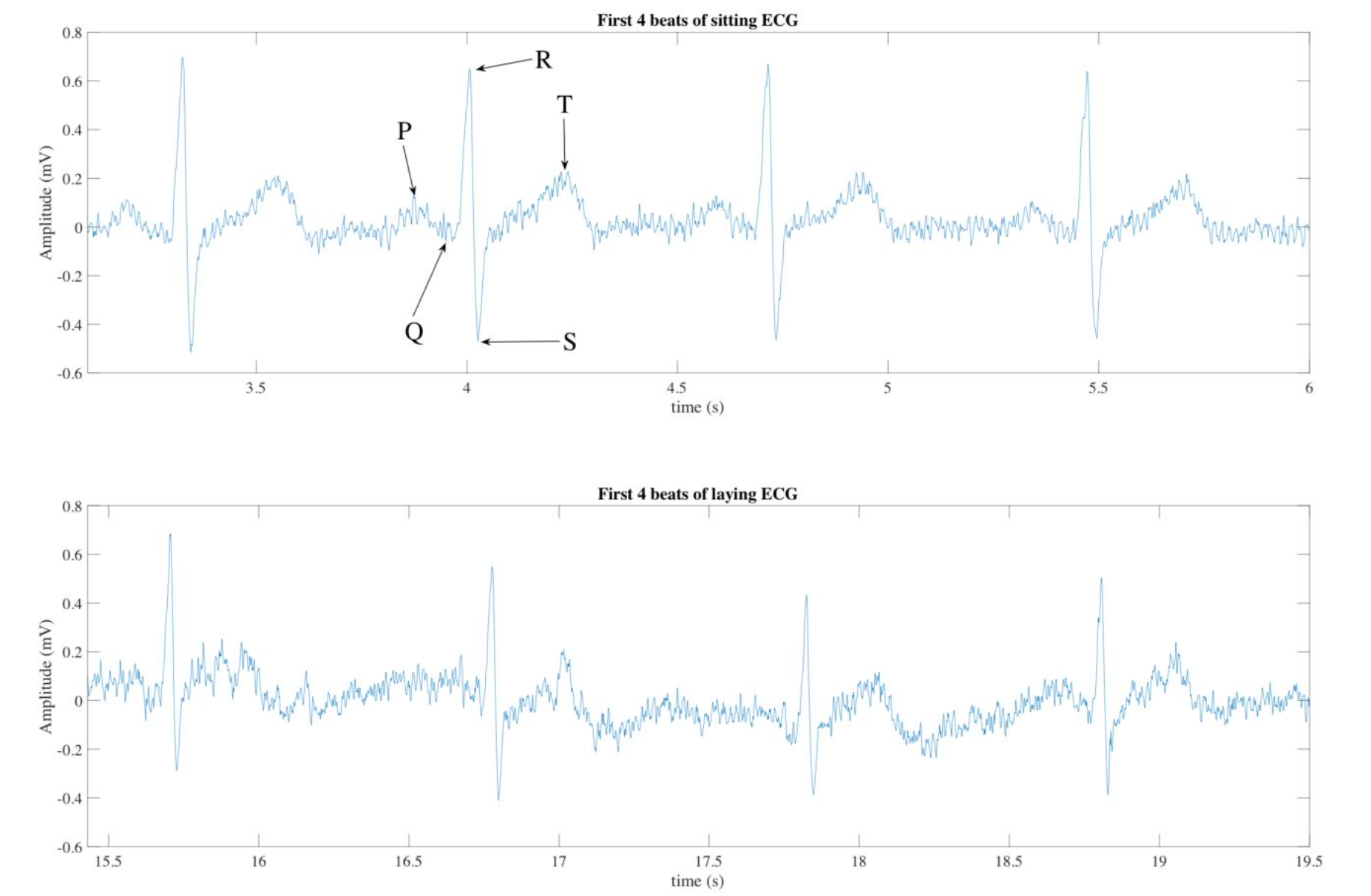 GitHub - treastorgavin/Biosignals_ECG_signalprocessing