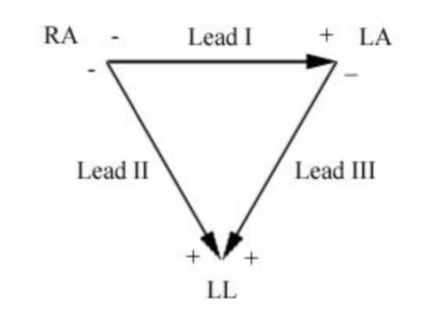 GitHub - treastorgavin/Biosignals_ECG_signalprocessing