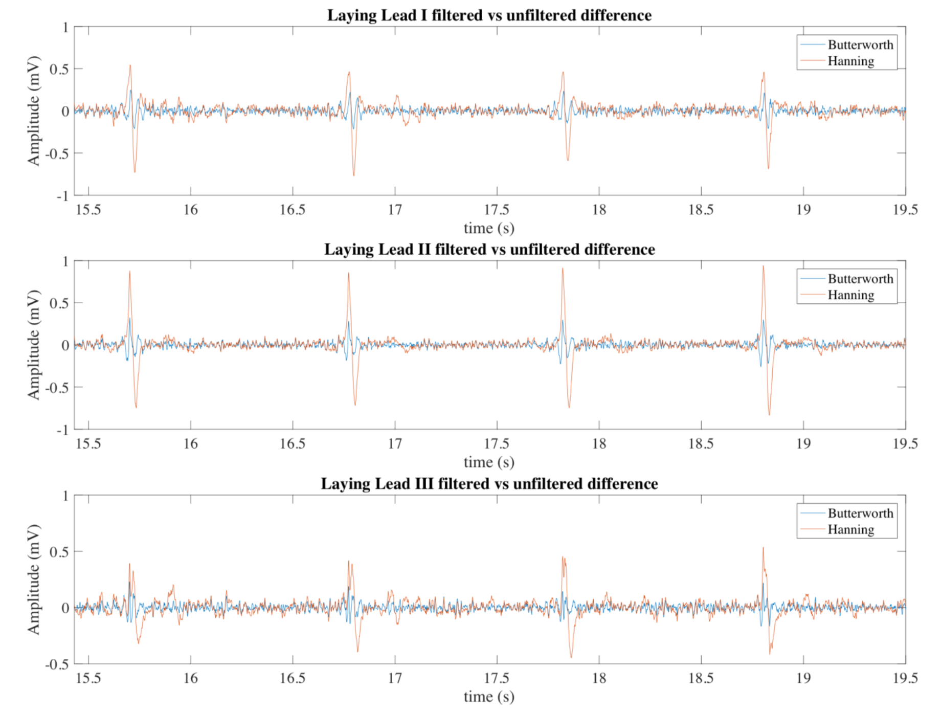 GitHub - treastorgavin/Biosignals_ECG_signalprocessing