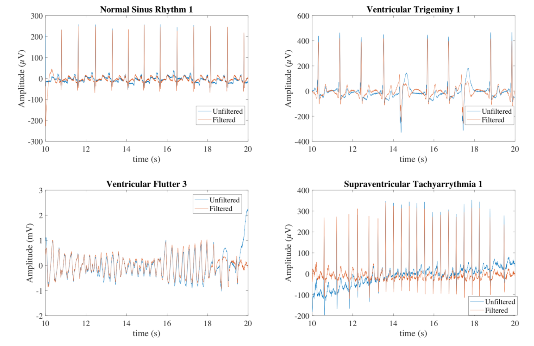 GitHub - treastorgavin/Biosignals_ECG_signalprocessing