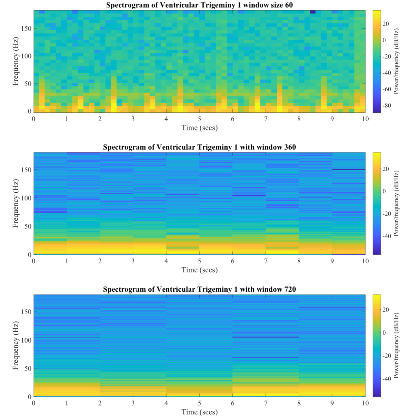 GitHub - treastorgavin/Biosignals_ECG_signalprocessing