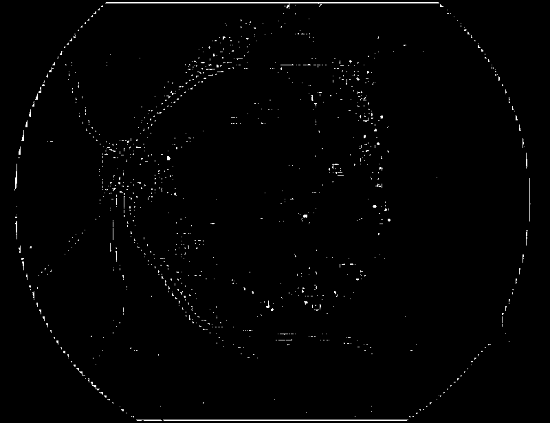 GitHub - RahulSharma4538/Diabetic-Retinopathy-Detection