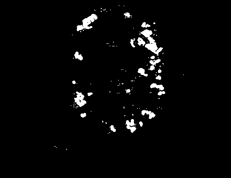 GitHub - RahulSharma4538/Diabetic-Retinopathy-Detection