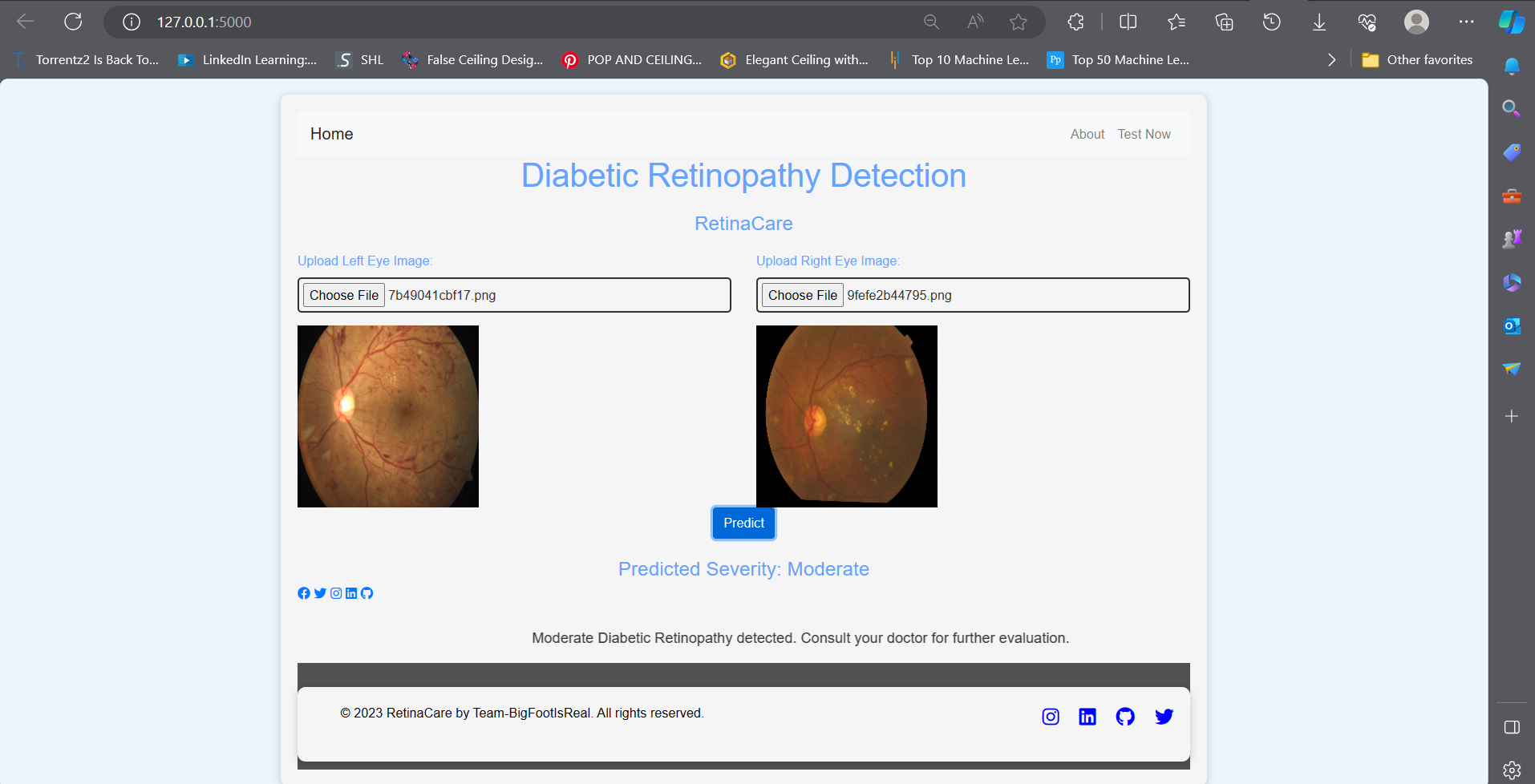 GitHub - RahulSharma4538/Diabetic-Retinopathy-Detection
