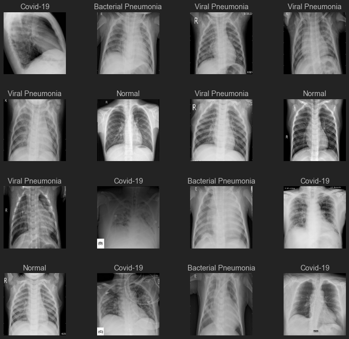 GitHub - ANKITZEAL/Chest-X-Ray-Classification-Using-AI