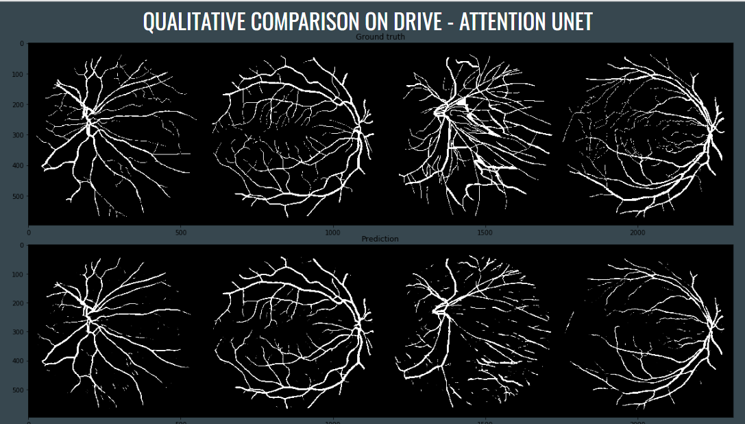 GitHub - Sakshat17/Skin-Lesion-and-Wound-Segmentation: Determined lesions and wounds’ outline by ...