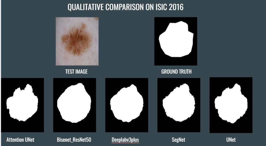GitHub - Sakshat17/Skin-Lesion-and-Wound-Segmentation: Determined lesions and wounds’ outline by ...
