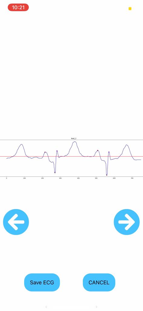 GitHub - rhythmjain18/ECG-Digitization-App-using-ML-and-React-Native